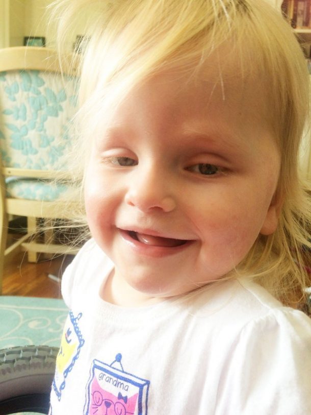 Sarah: Potocki- Shaffer Syndrome - Orangesocks.org