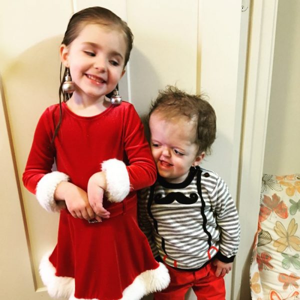 Megan and Josh: Apert Syndrome - Orangesocks.org
