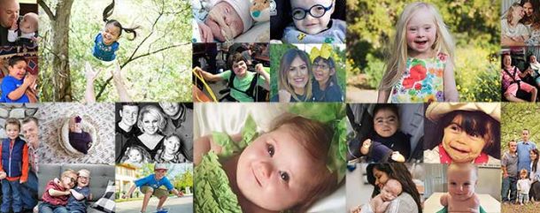 Adrianne and Jason: Tetra-Amelia Syndrome - Orangesocks.org