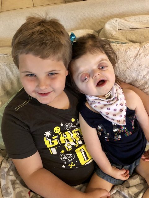 Kristy and Andrew: Pfeiffer Syndrome - Orangesocks.org